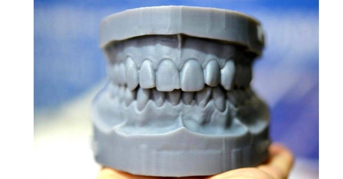 Why dental 3D printing is becoming more popular in dentistry? – ADAE ...