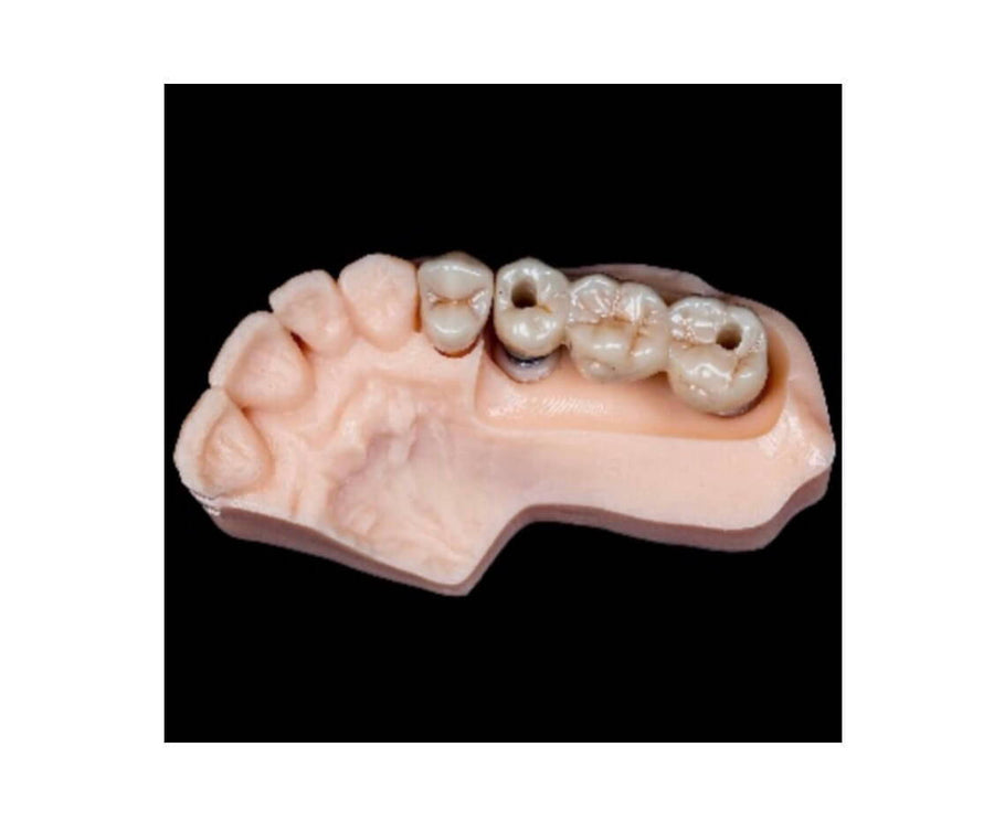 How to scan Implant models using scan body by our Shining 3D dental Lab ...