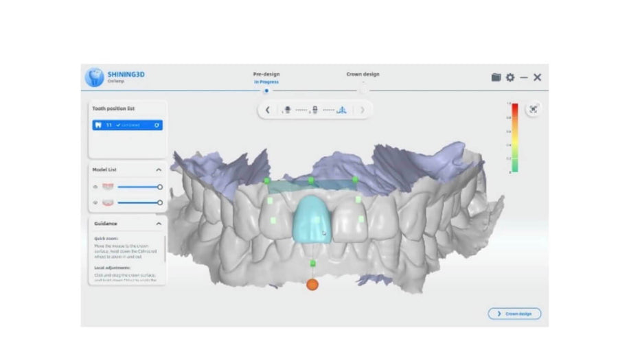 How to scan Implant models using scan body by our Shining 3D dental Lab ...
