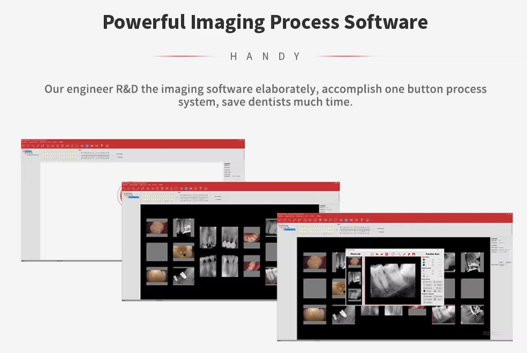 Handy digital imaging plate scanner HDS-500-Upgraded version – ADAE ...
