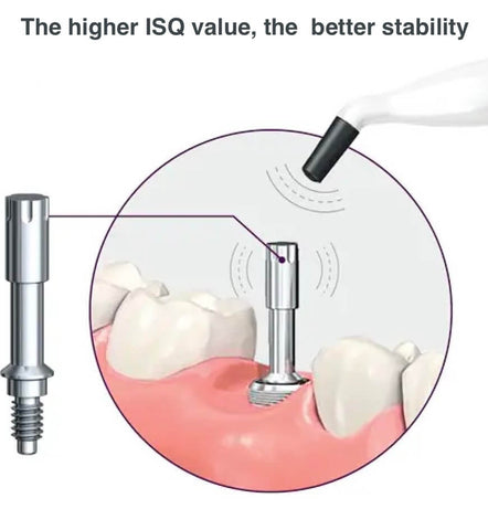 ADAE AD50 Dental Implant Stability Meter – ADAE Dental Online Store
