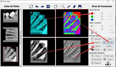 ATECO sensor X-ray sensor (UK-made)-New upgraded version – ADAE Dental ...